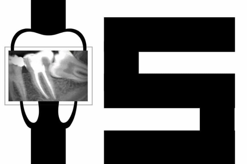 New Zealand Dental Association | Interpretation of CBCT – What a…